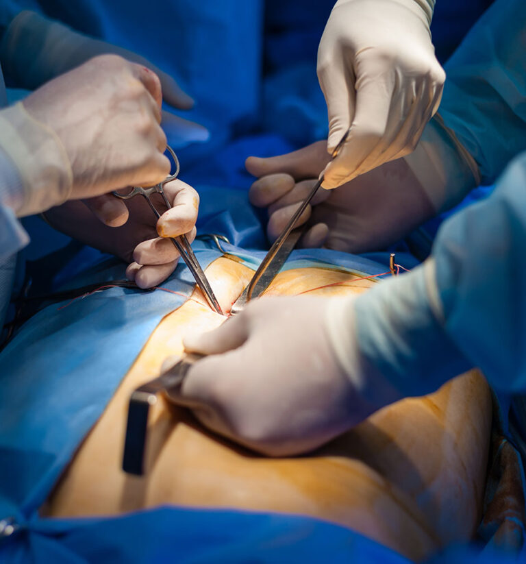 Best Gallbladder Surgery Gallbladder Disease Symptoms And Types